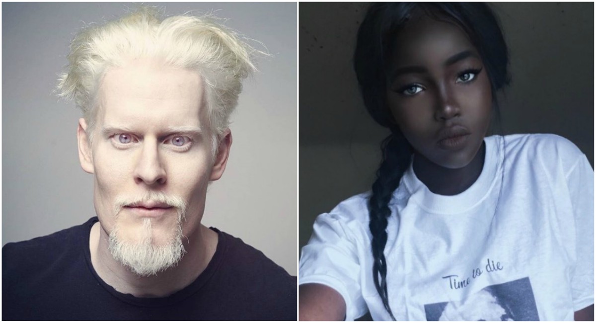 8 personas que lucen con orgullo su peculiar y único color de piel | Upsocl